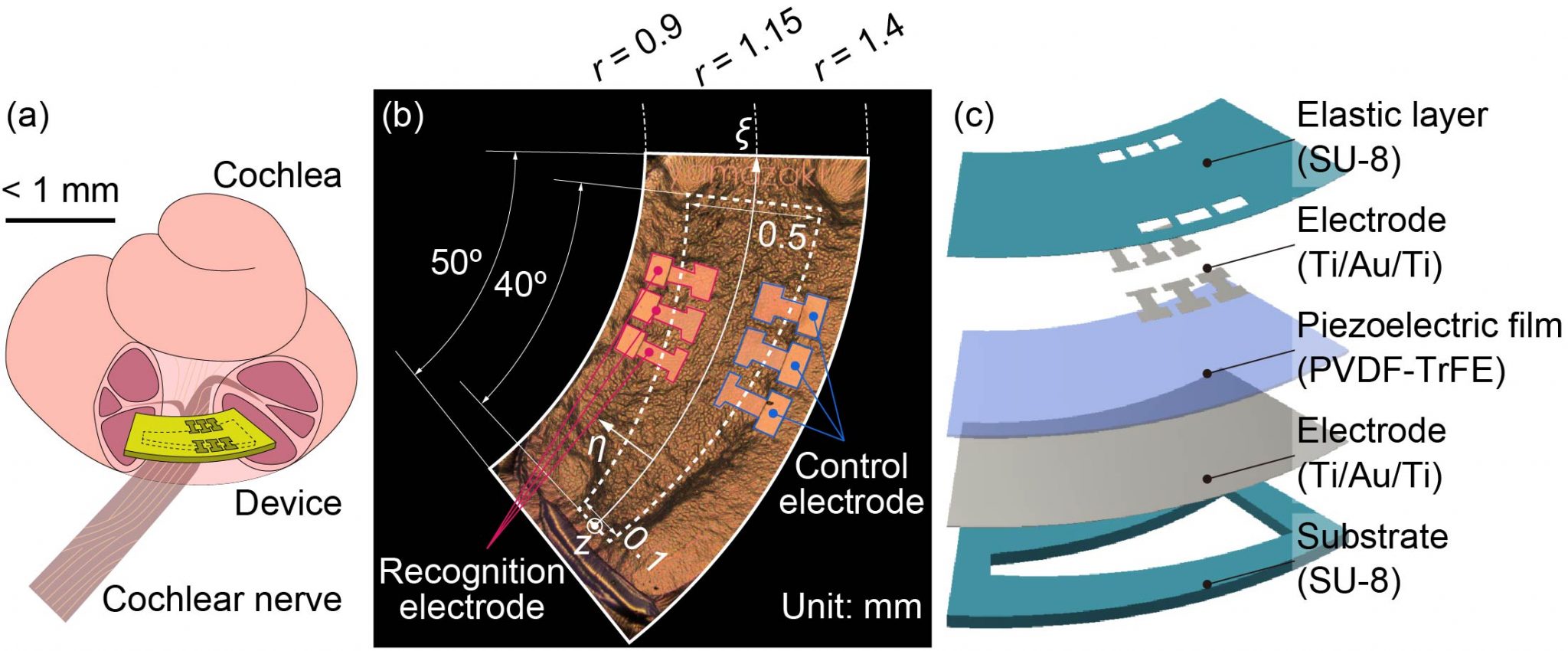 Next-generation fully insertable cochlear implant | Co-creation Bureau ...